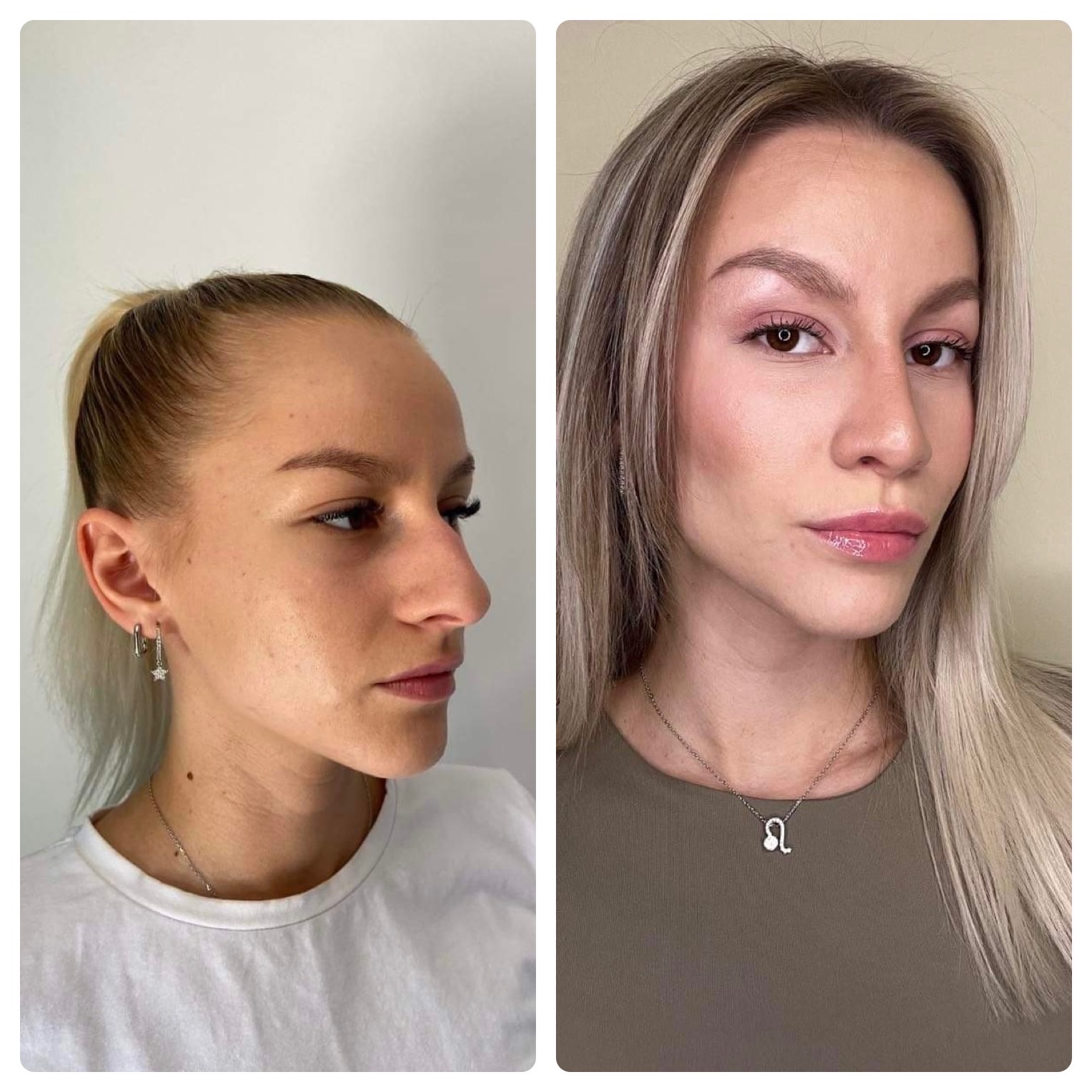 Galéria - Dr. Járai Tamás